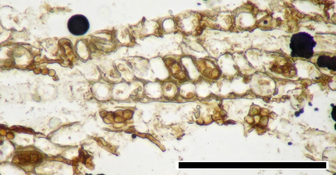 Exquisitely preserved tiny fossils are key for understanding moss evolution